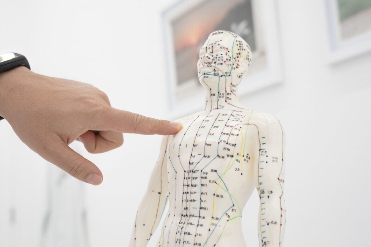 Acupuncture in Dubai - Traditional Chinese Medicine (TCM) - DNA Clinics