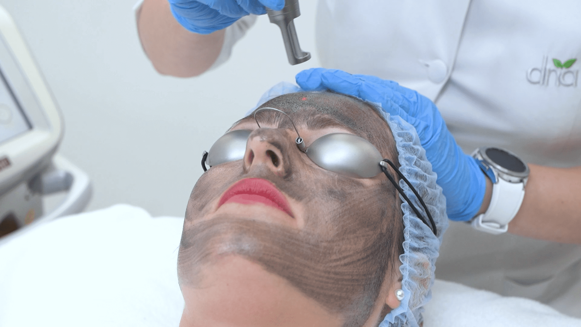 Laser Facials Treatments | DNA Health Clinics Dubai, UAE